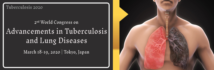 Tuberculosis 2020 | Tuberculosis | Lung Diseases | COPD | Conference ...